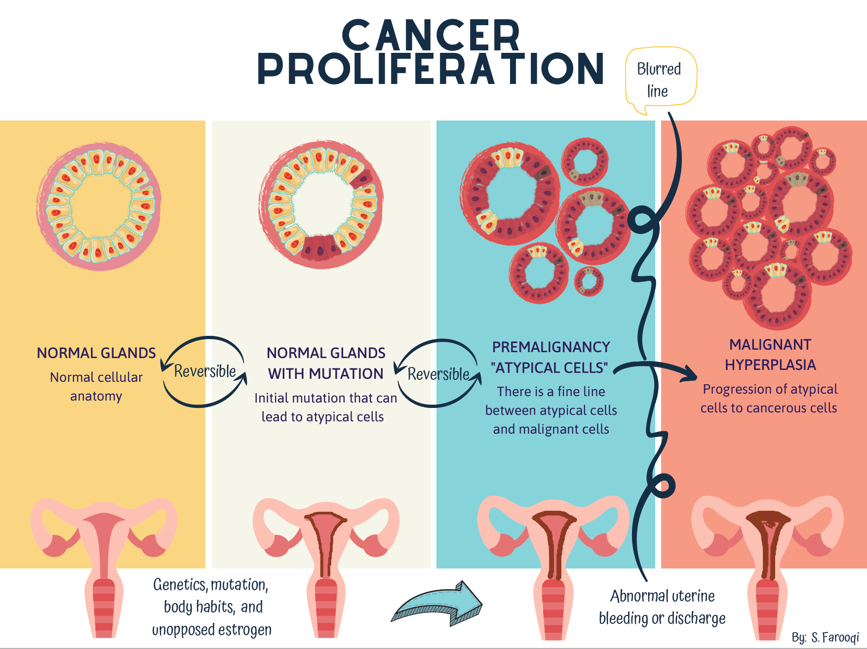 Fertility Preservation in Endometrial Cancer